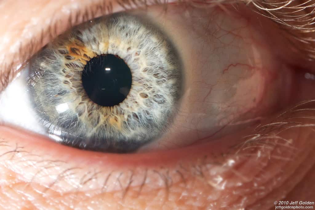 Retinal 'implants' could restore sight for millions - Positive News ... Retinal 'implants' could restore sight for millions - Positive News ...